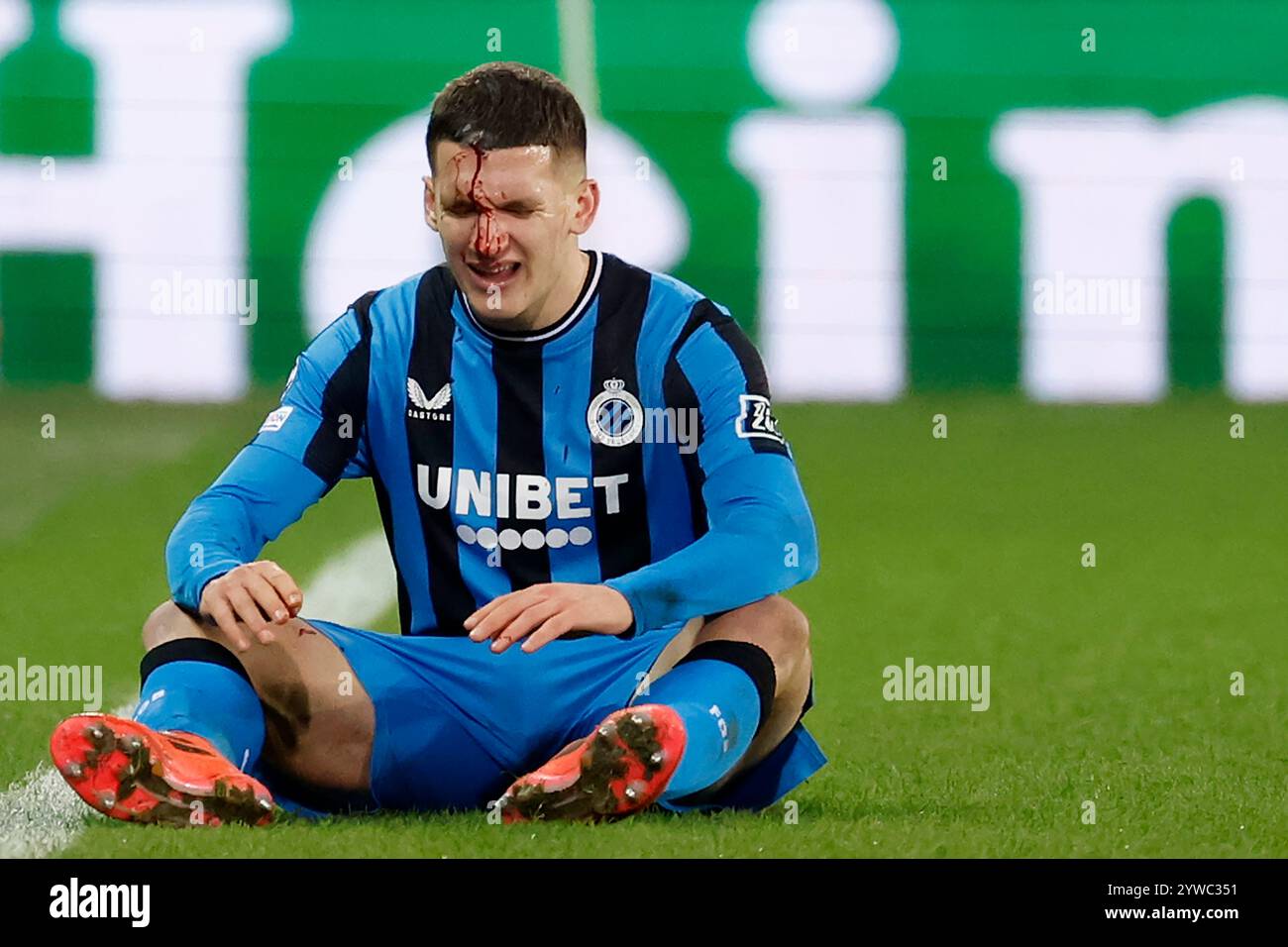 Brugge's Christos Tzolis sits on the pitch as he bleeds from a wound on ...