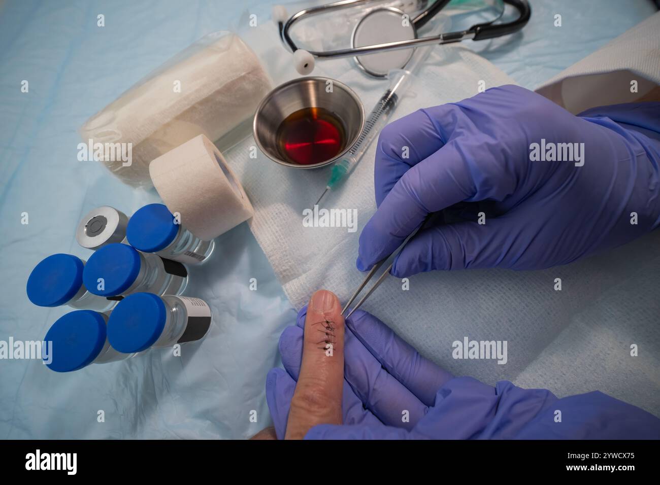Stitched finger with medical instruments, about to remove sutures Stock ...