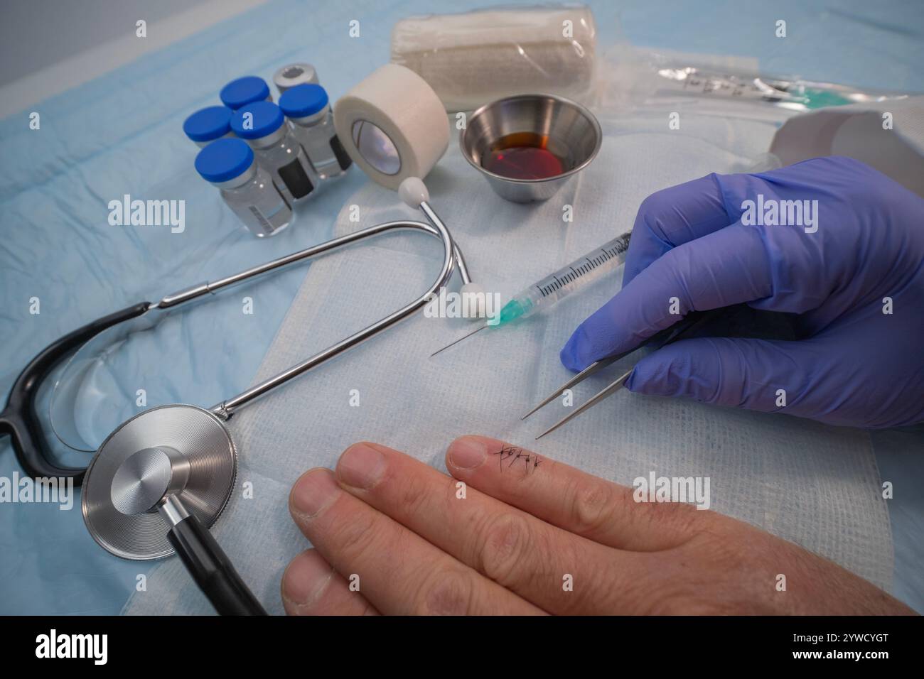 Stitched finger with medical instruments, about to remove sutures Stock ...