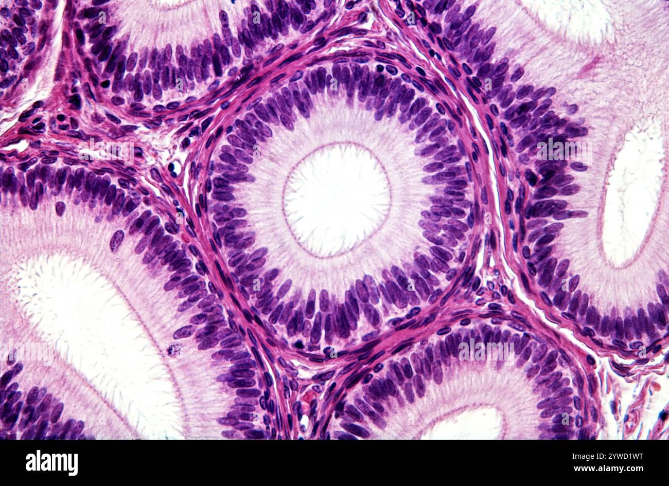 Light micrograph of epididymal ducts lined by pseudostratified ...