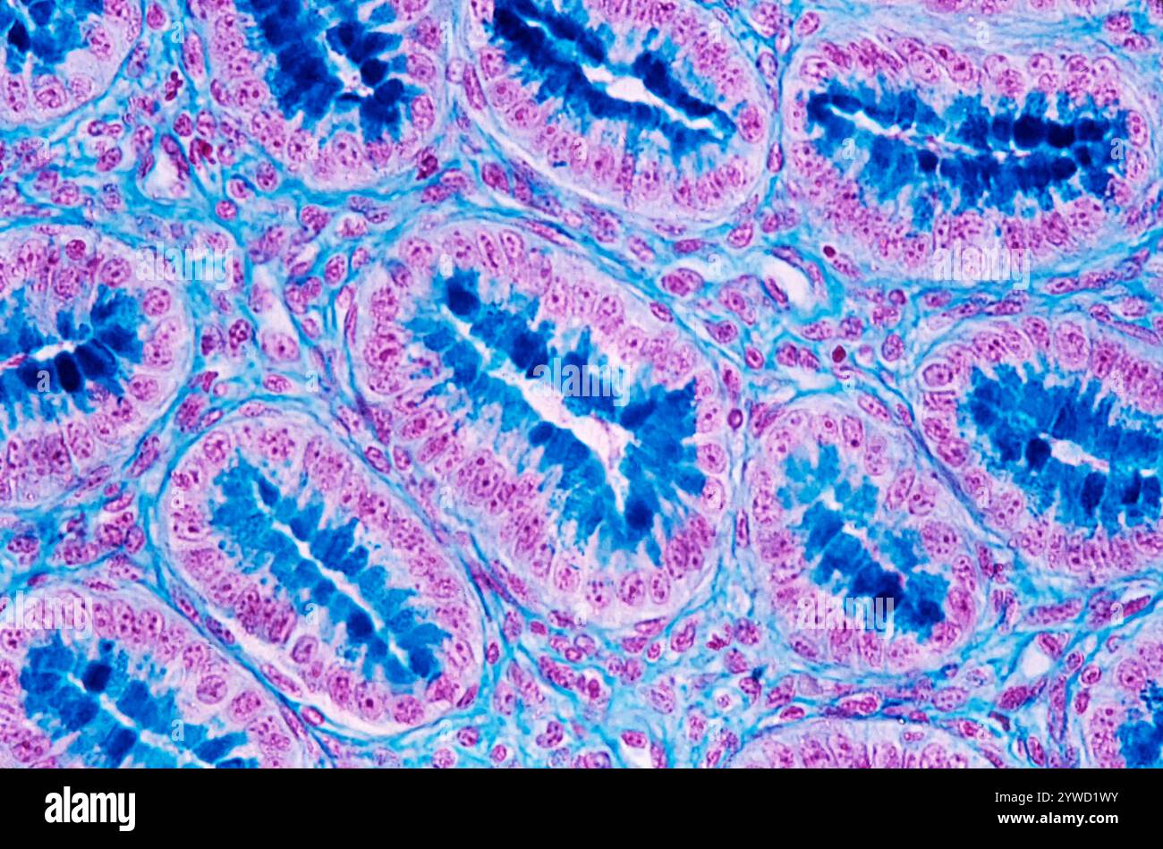 Light micrograph showing the mucous epithelium of gastric pits stained ...