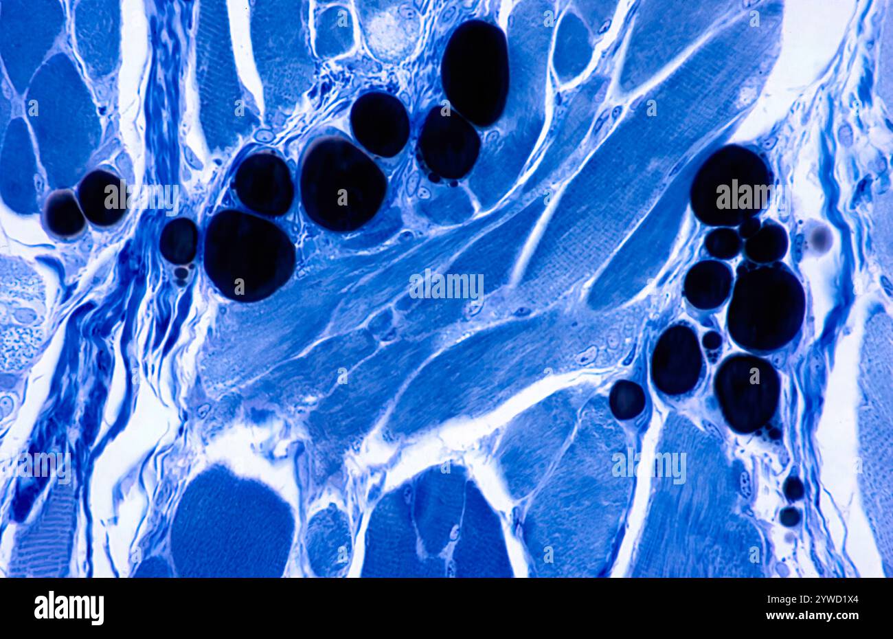 Light micrograph of white adipocytes, or fat cells, among skeletal ...