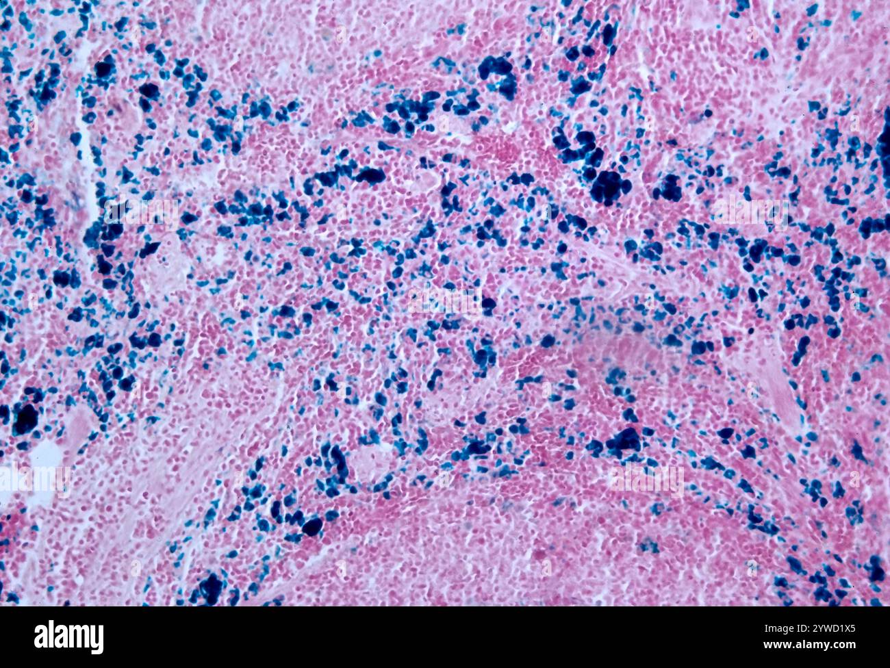 Light micrograph of a section of the stratum spinosum of the skin's ...