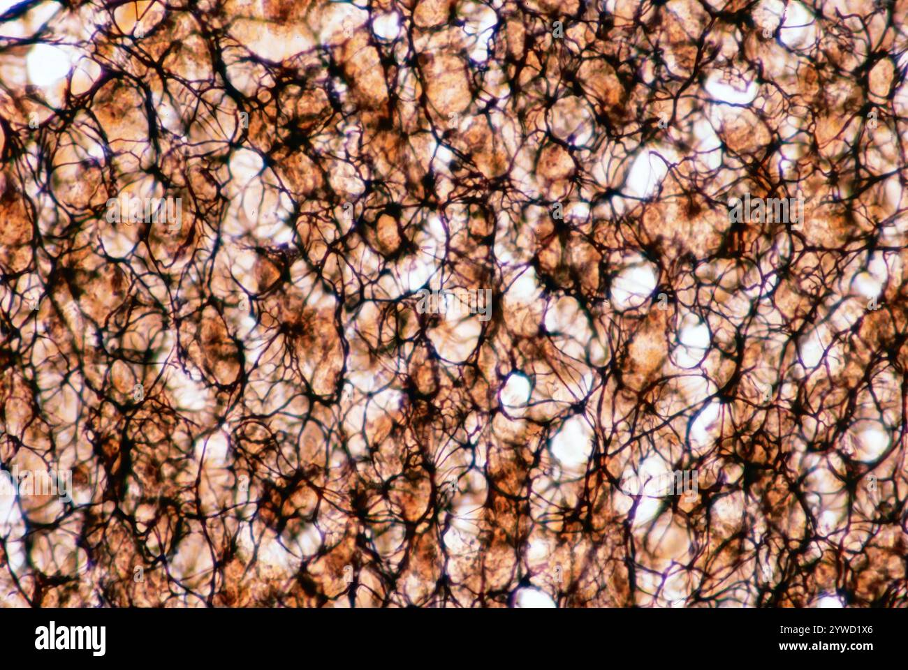 Reticular fibres, light micrograph. Reticular fibres are a type of ...