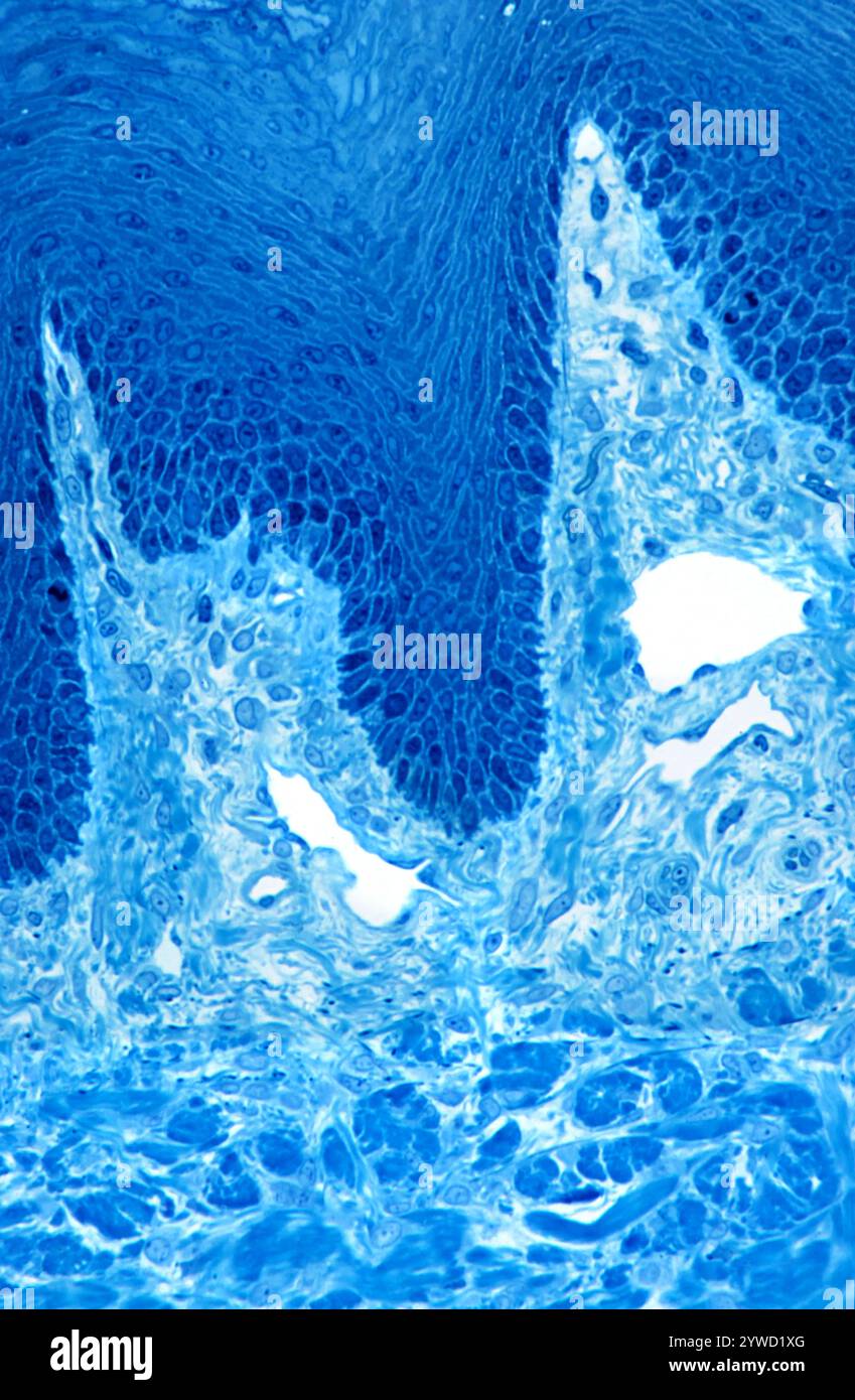 Light micrograph of two dermal papillae separated by an epidermal rete ...