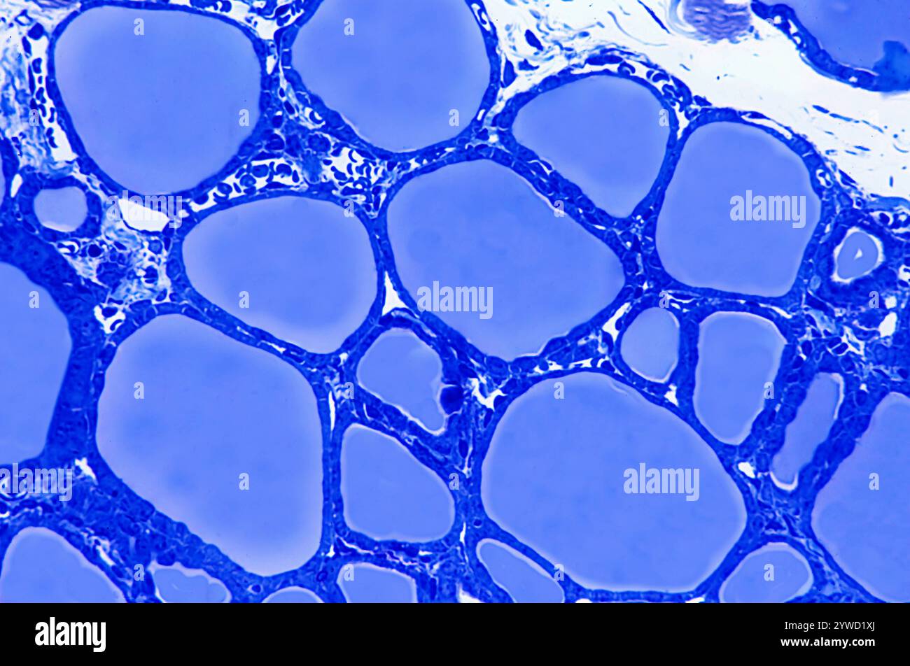 Light micrograph of thyroid follicles showing homogeneous central ...