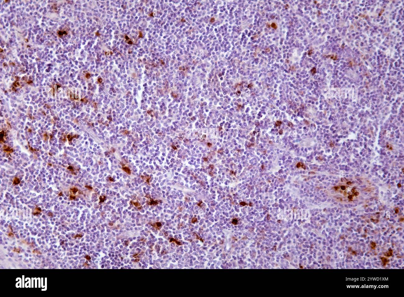 Human tonsil, light micrograph. Stained with the immunohistochemical method for detection of ...