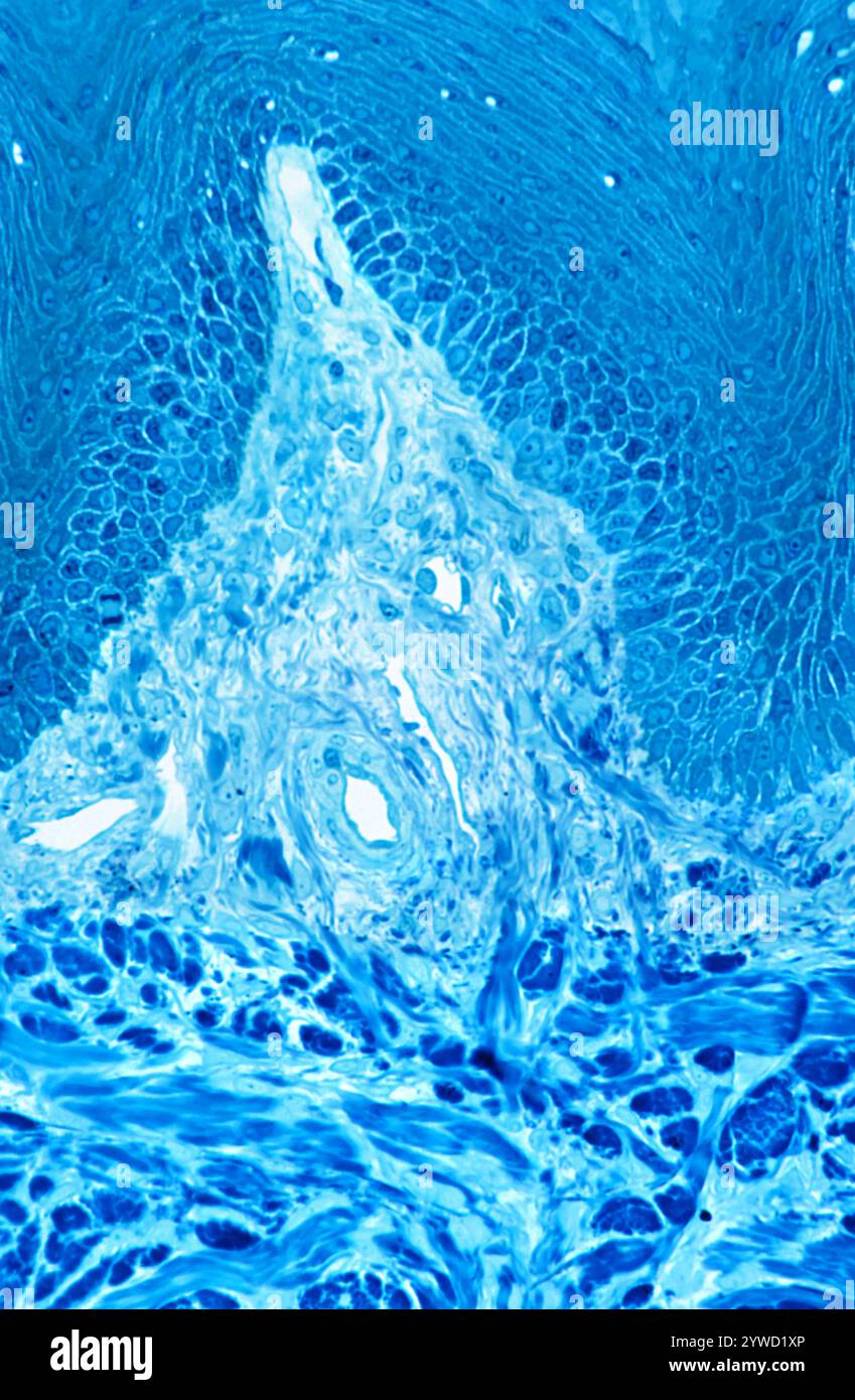 Light micrograph of a dermal papilla showing a loose connective tissue ...