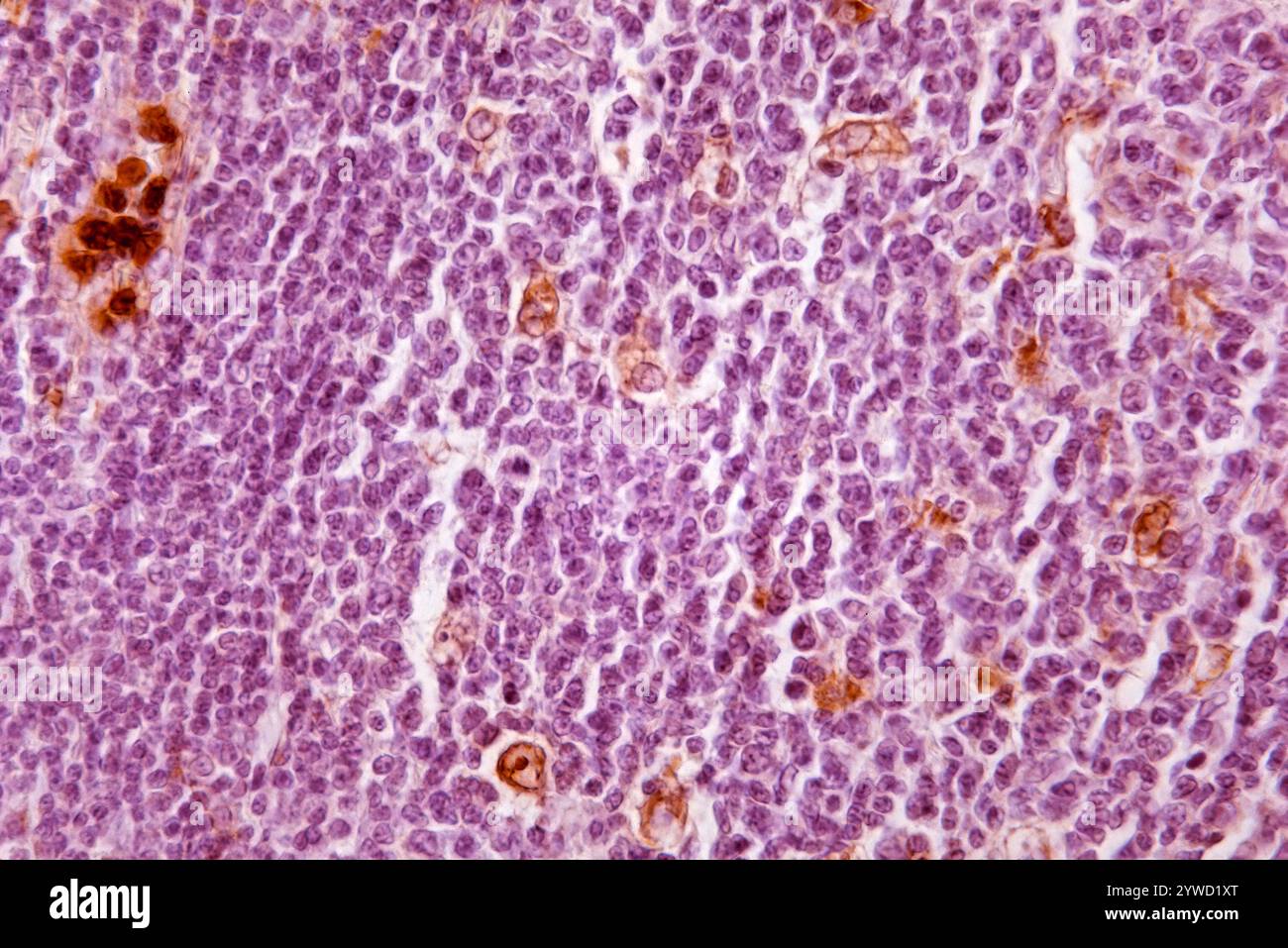 Human tonsil, light micrograph. Stained with the immunohistochemical method for detection of ...