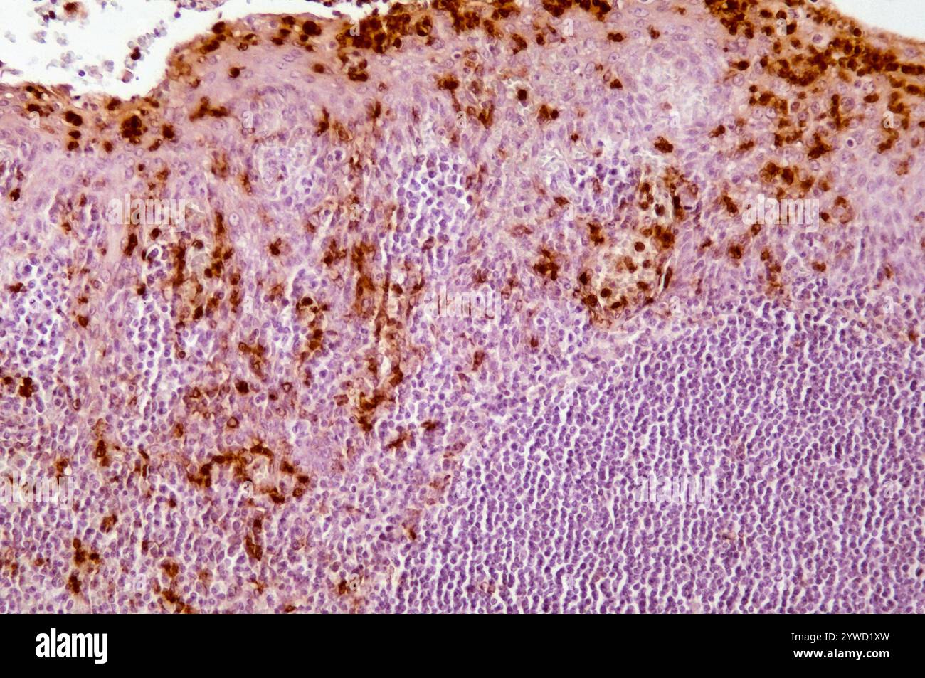 Human palatine tonsil, light micrograph. Stained with the immunohistochemical method for ...