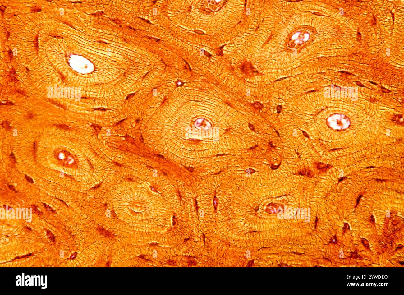 Compact bone, light micrograph Stock Photo - Alamy