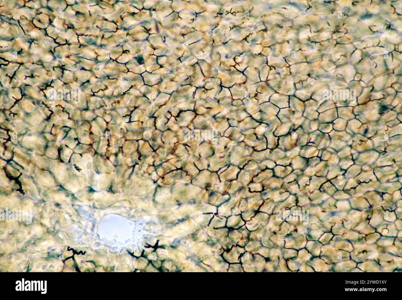 Light micrograph of bile canaliculi in the liver stained with the Golgi ...