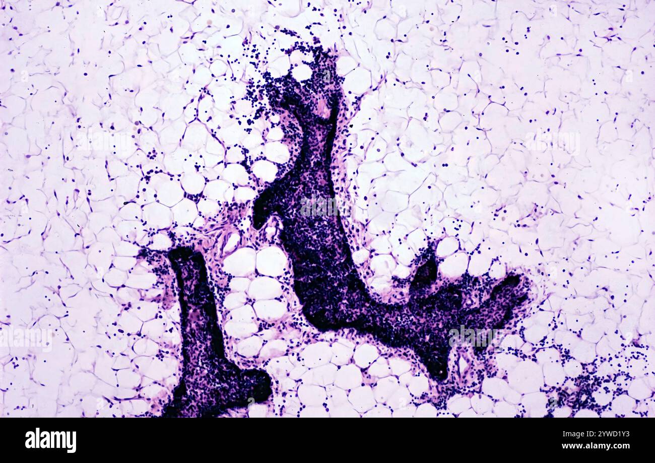 Light micrograph of a thymus lobule of an older person. The thymic ...