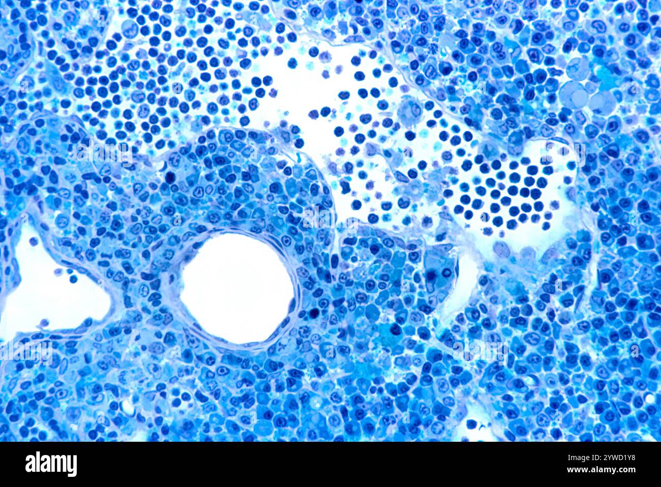 Light micrograph of the medulla of a lymph node showing medullary cords ...