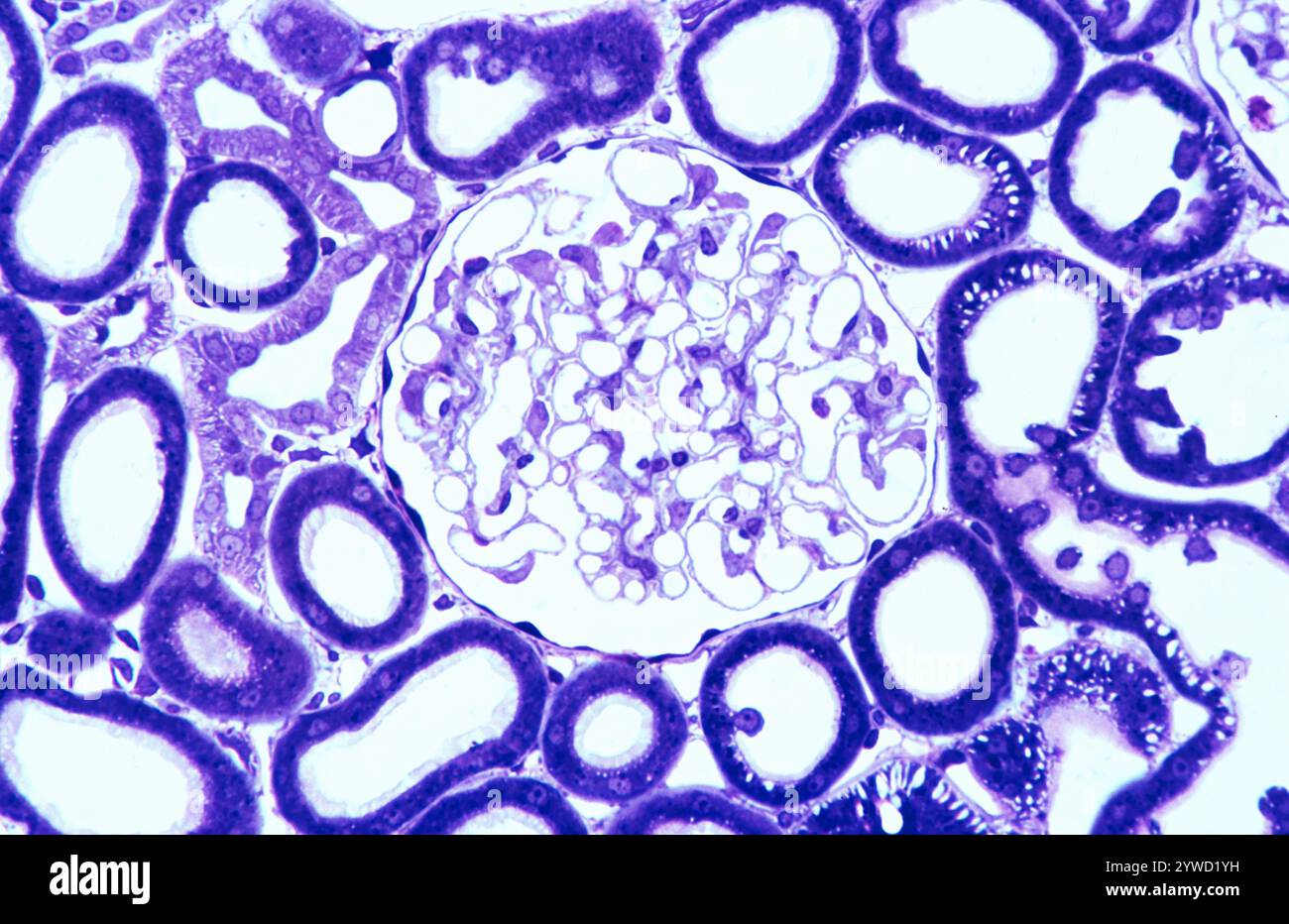 Renal cortex, light micrograph. At centre is a renal corpuscle in which ...