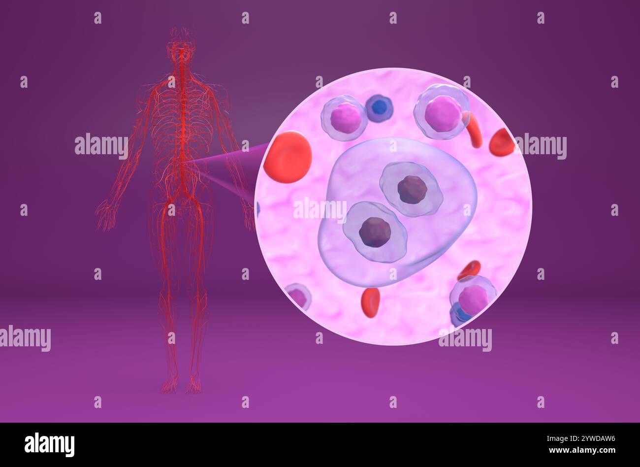 Hodgkin lymphoma (HL) cells in the blood flow - isometric view 3d ...