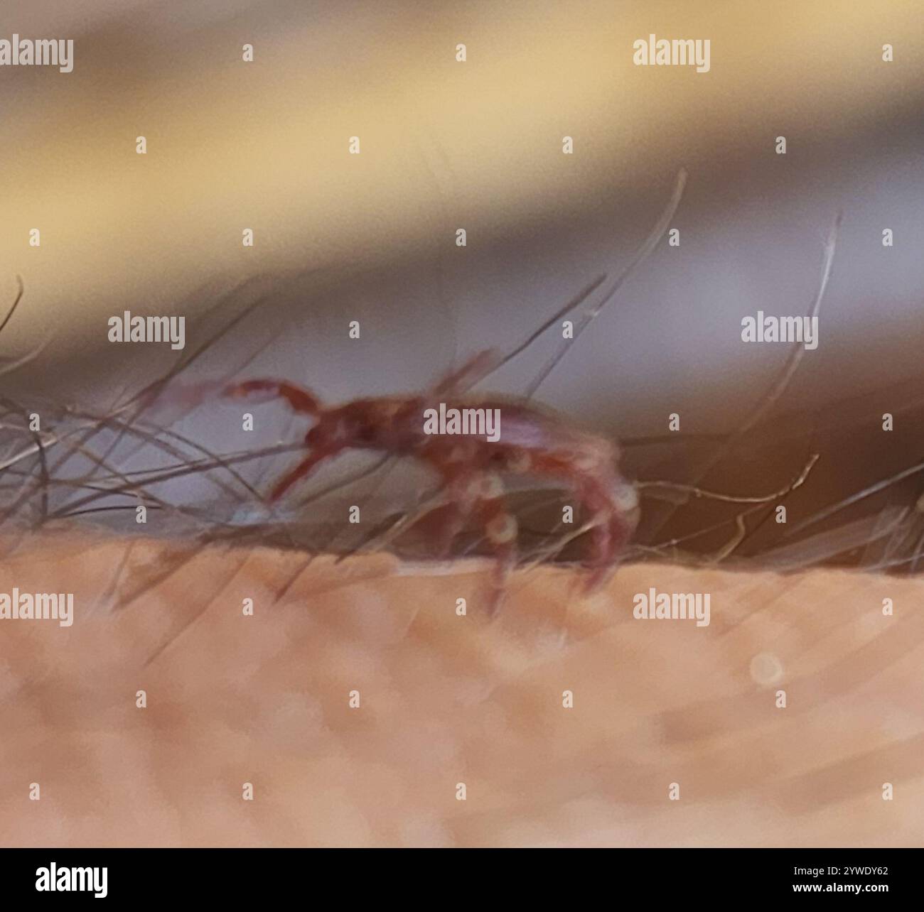 American Dog Tick (Dermacentor variabilis Stock Photo - Alamy