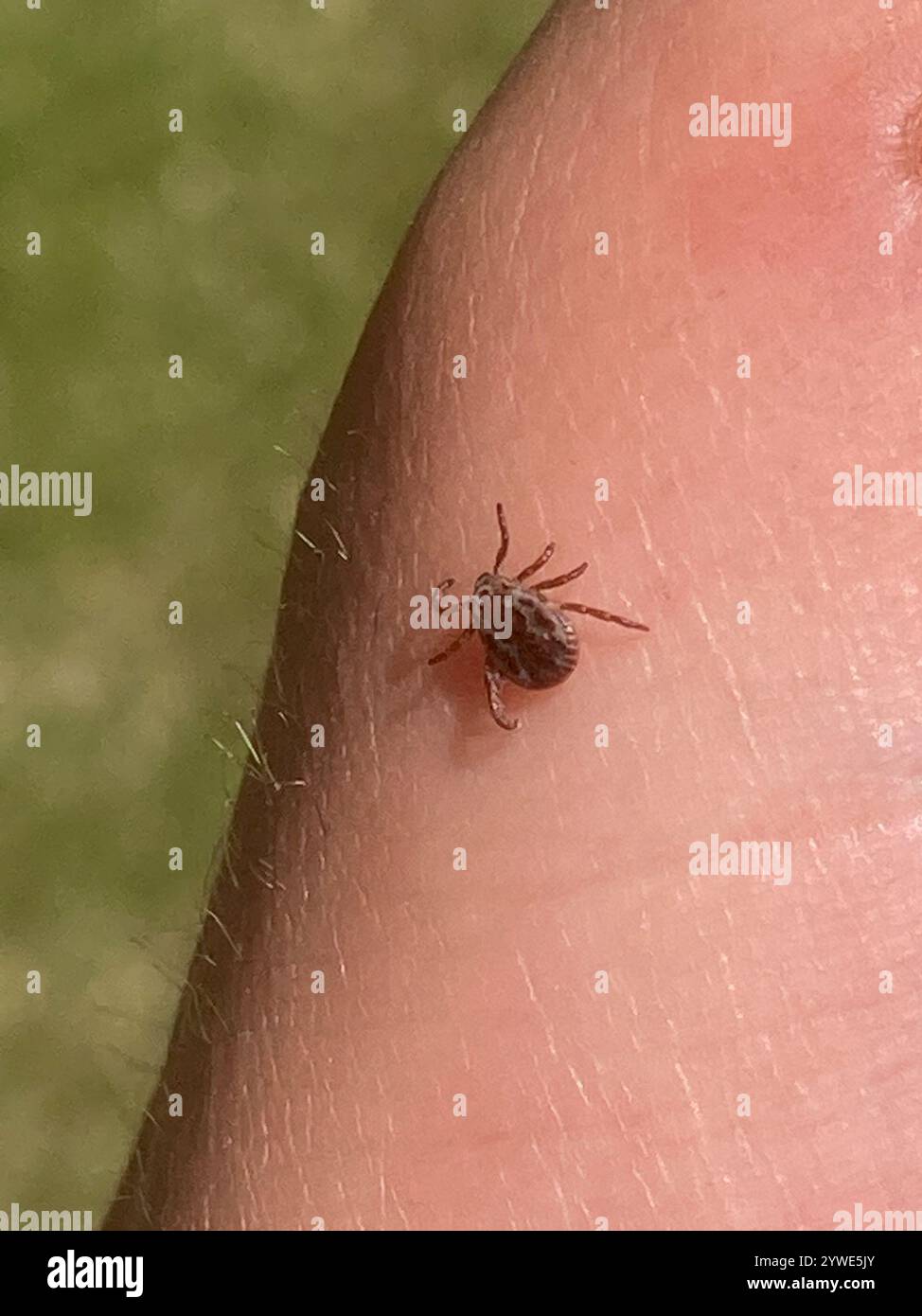 American Dog Tick (Dermacentor variabilis Stock Photo - Alamy