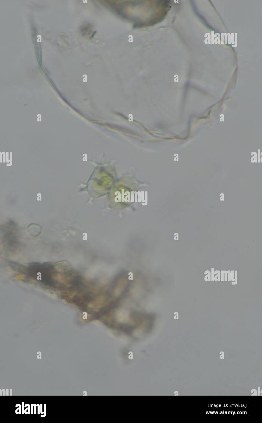 Staurastrum furcatum hi-res stock photography and images - Alamy