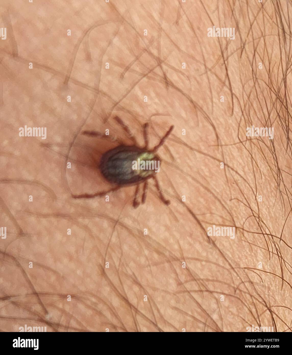 American Dog Tick (Dermacentor variabilis Stock Photo - Alamy