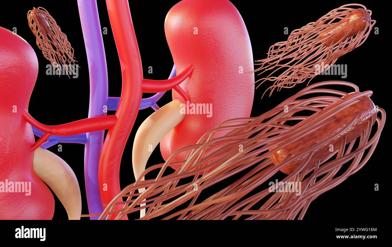 Proteus mirabilis bacteria reach the kidneys, called pyelonephritis ...