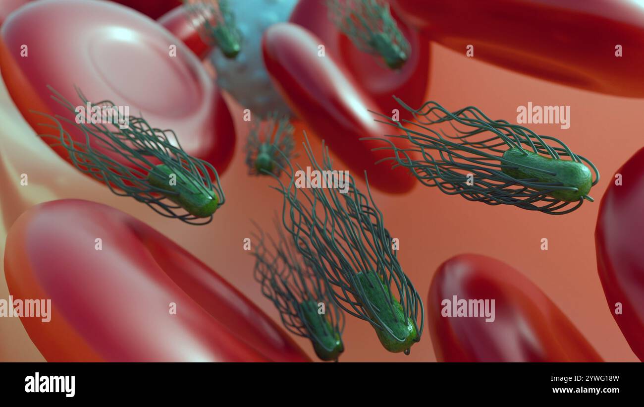 Proteus Mirabilis Rash Microbiologics : 0440A Proteus Mirabilis