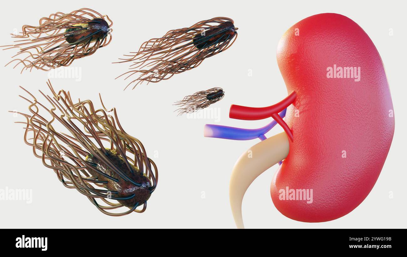 Proteus mirabilis bacteria reach the kidneys, called pyelonephritis ...