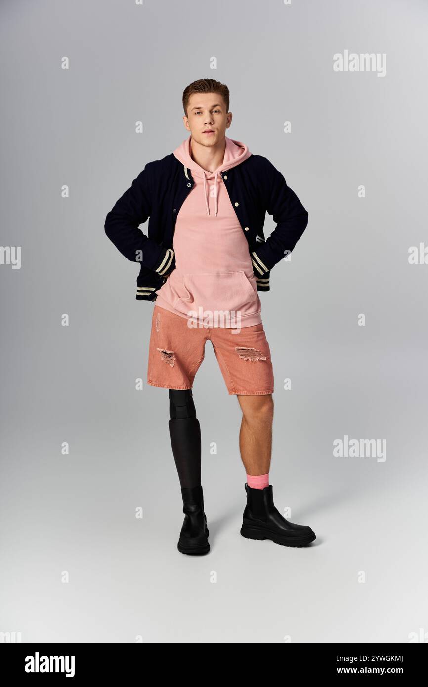 Young man in casual wear confidently showcases his prosthetic leg ...