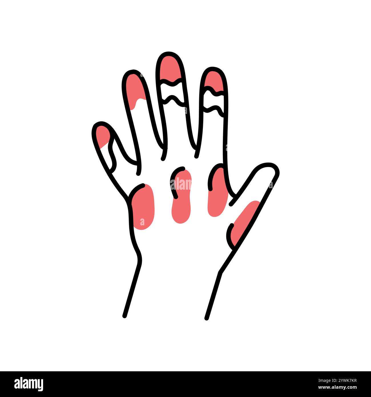 Dermatomyositis color line icon. Autoimmune diseases. Vector isolated ...