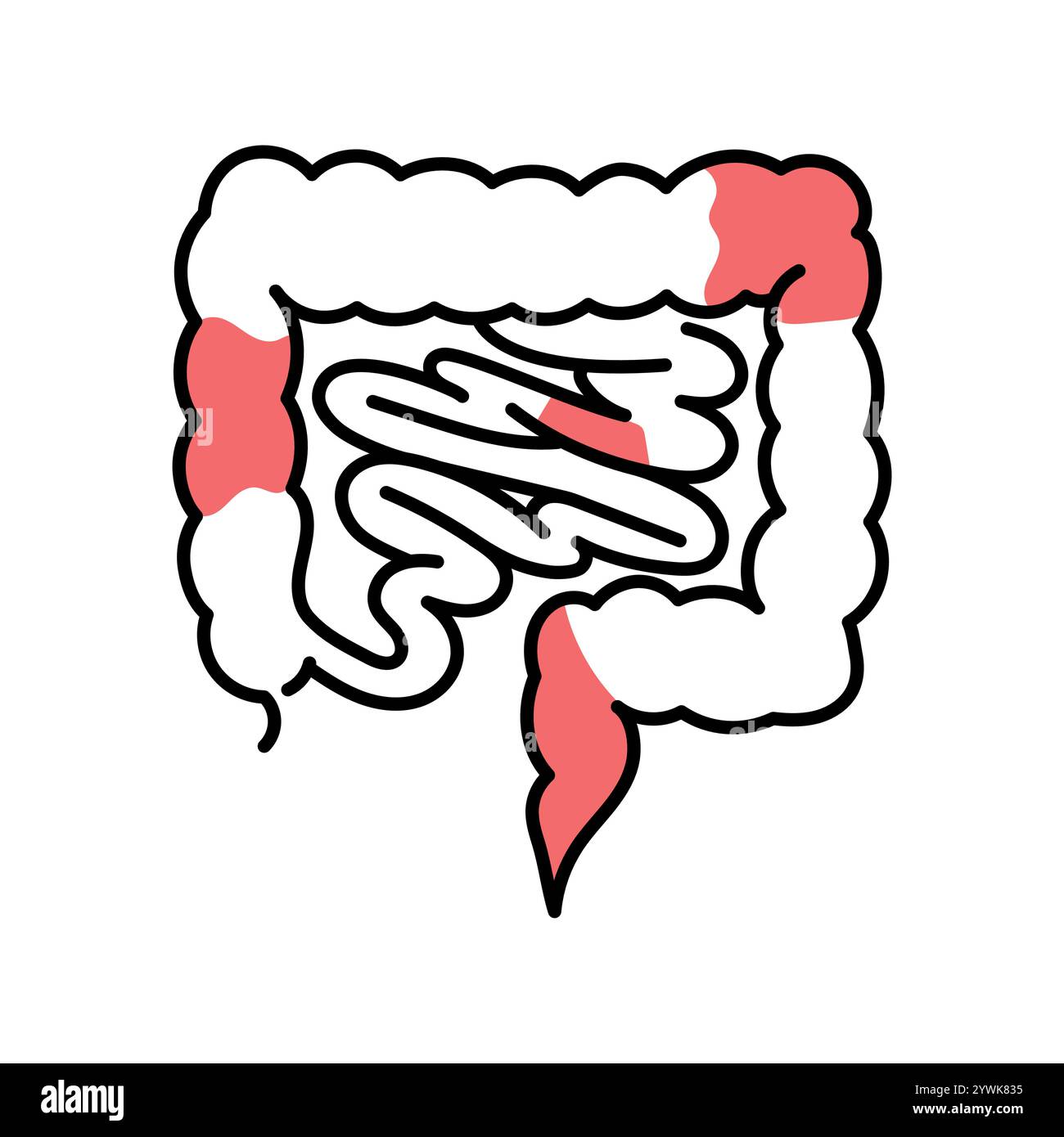 Colonoscopy cartoon hi-res stock photography and images - Alamy