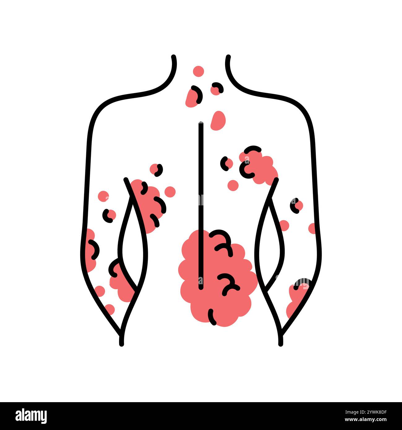 Psoriasis color line icon. Autoimmune diseases. Vector isolated element. Editable stroke Stock ...