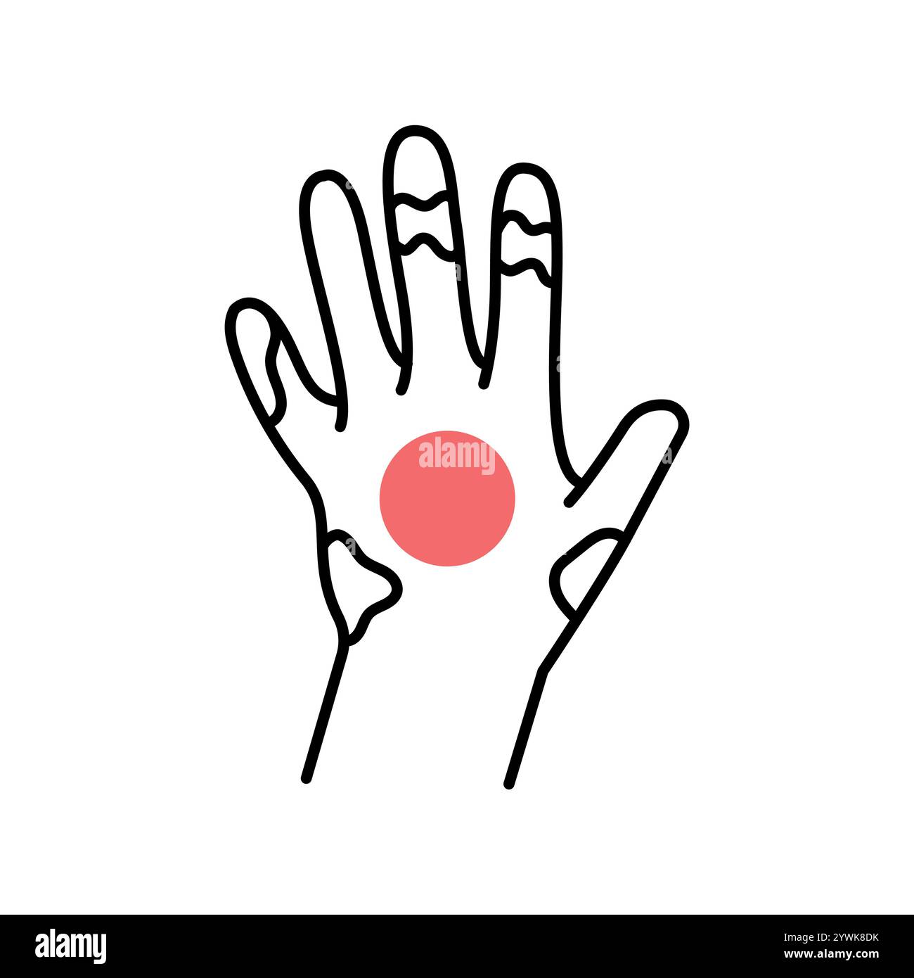 Systemic sclerosis scleroderma hi-res stock photography and images - Alamy