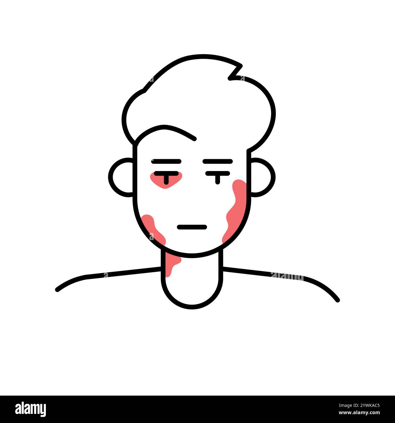 Sjogren's syndrome color line icon. Autoimmune diseases. Vector ...