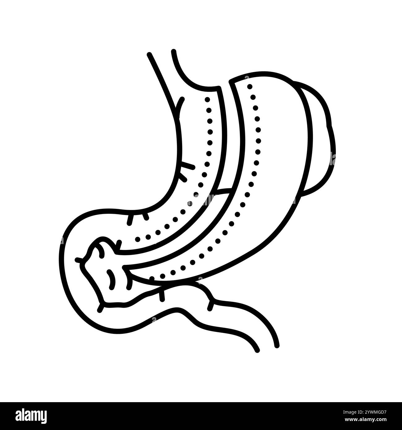 Gastrectomy line black icon. Sign for web page, mobile app, button ...