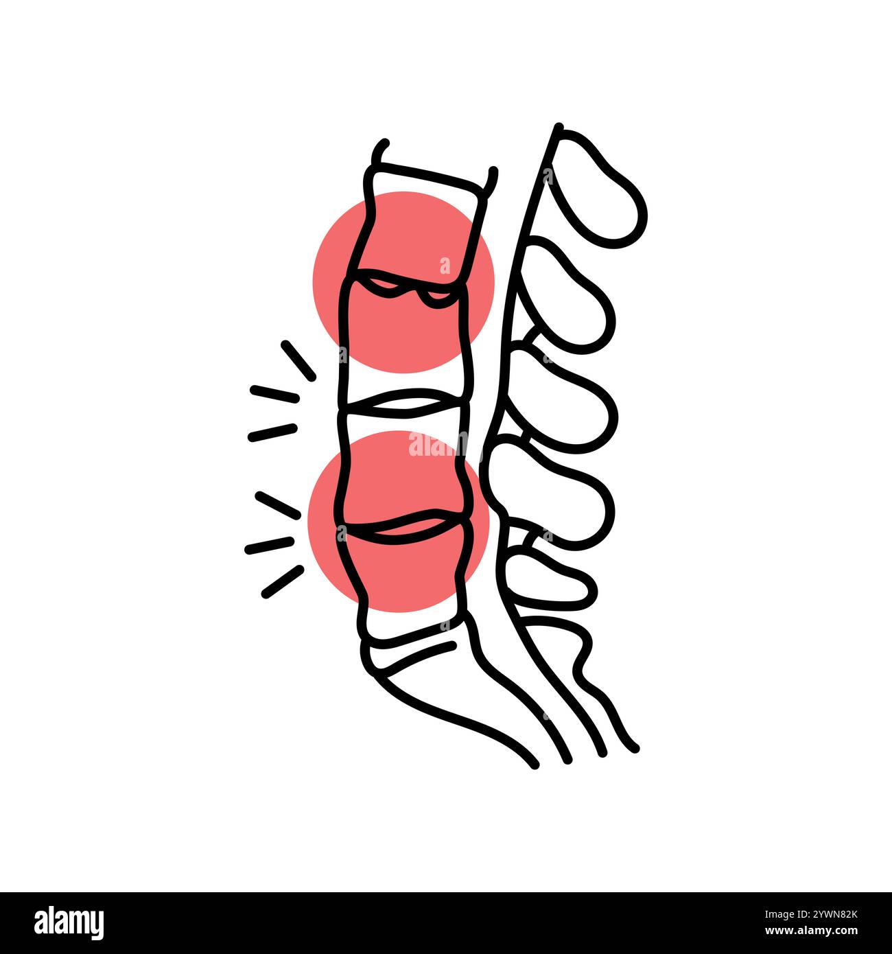 Ankylosing spondylitis color line icon. Diseases of the spine ...