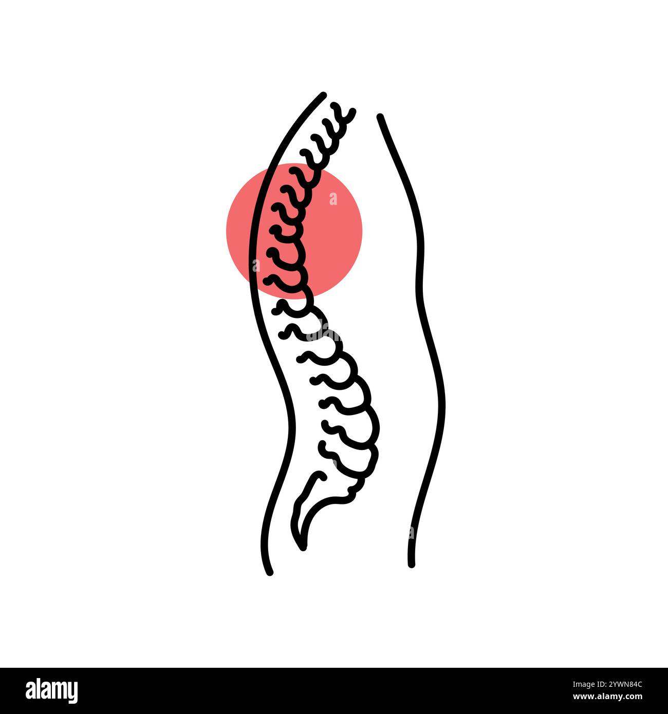 Kyphosis color line icon. Diseases of the spine. Vertebrology. Vector ...