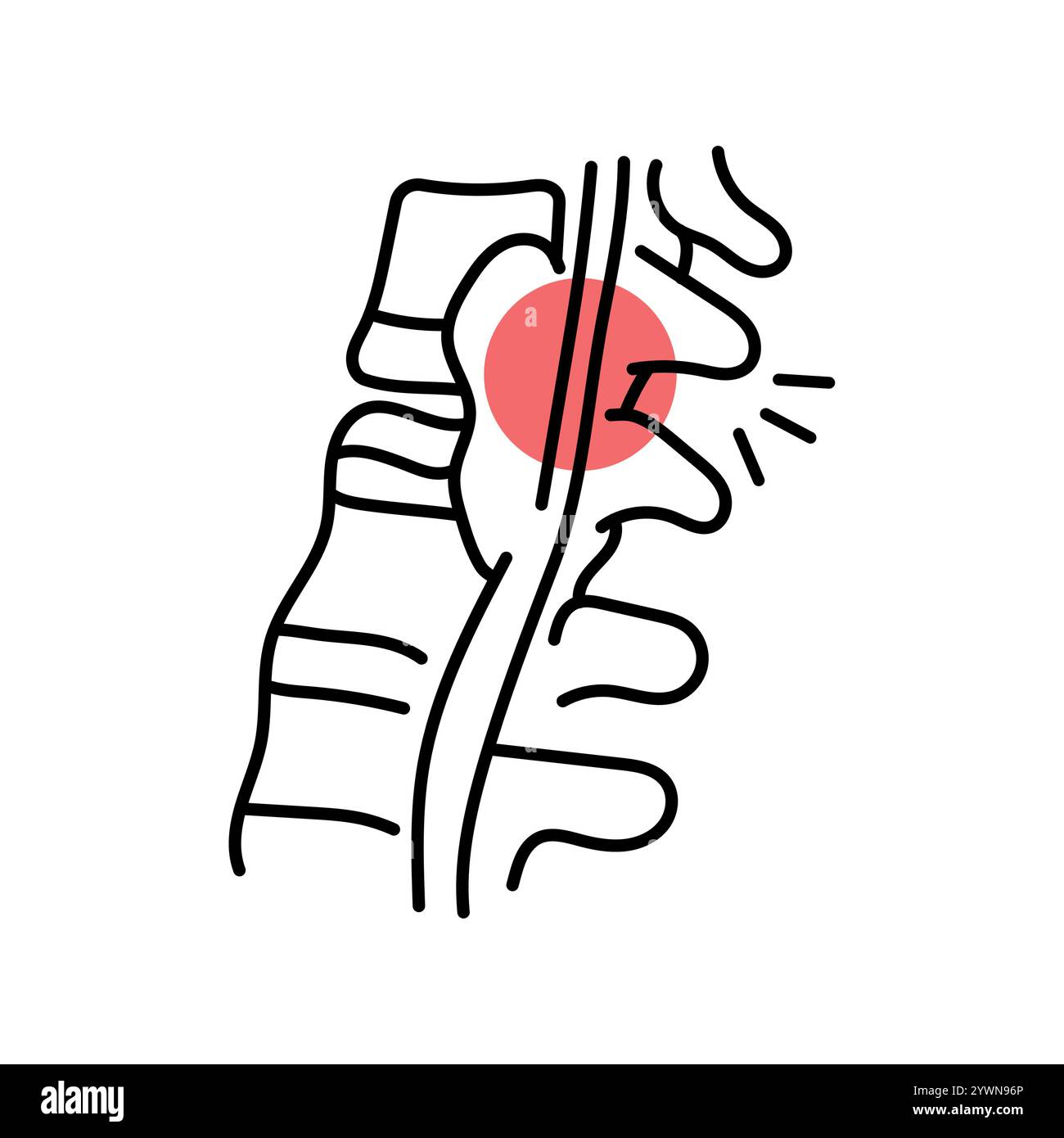 Metastatic lesion of the spine color line icon. Diseases of the spine ...