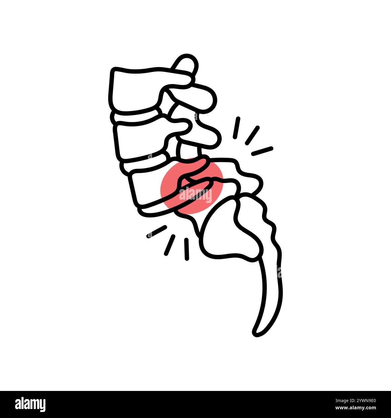 Displacement of the vertebra color line icon. Diseases of the spine ...