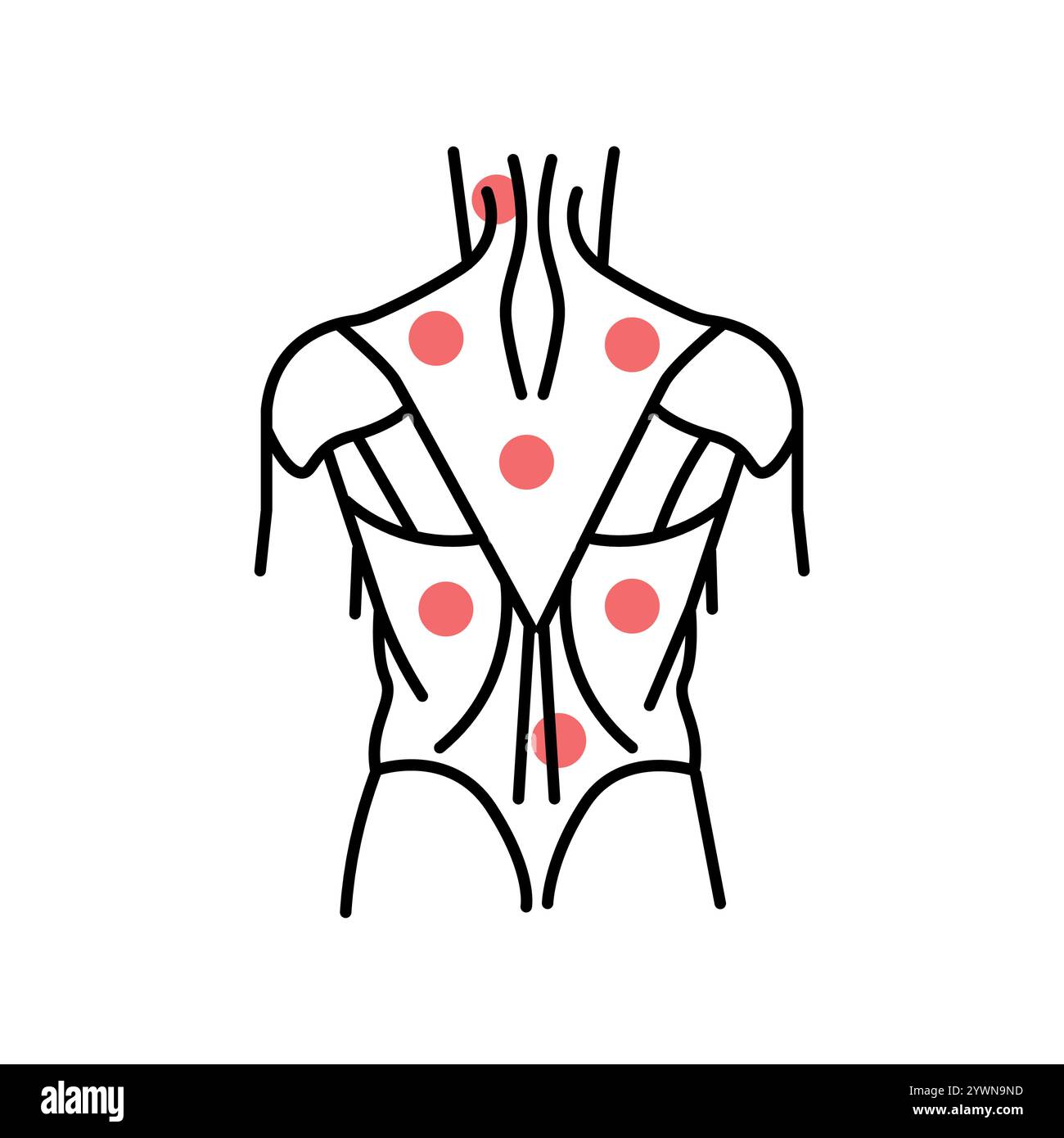 Myofascial pain syndrome Stock Vector Images - Alamy