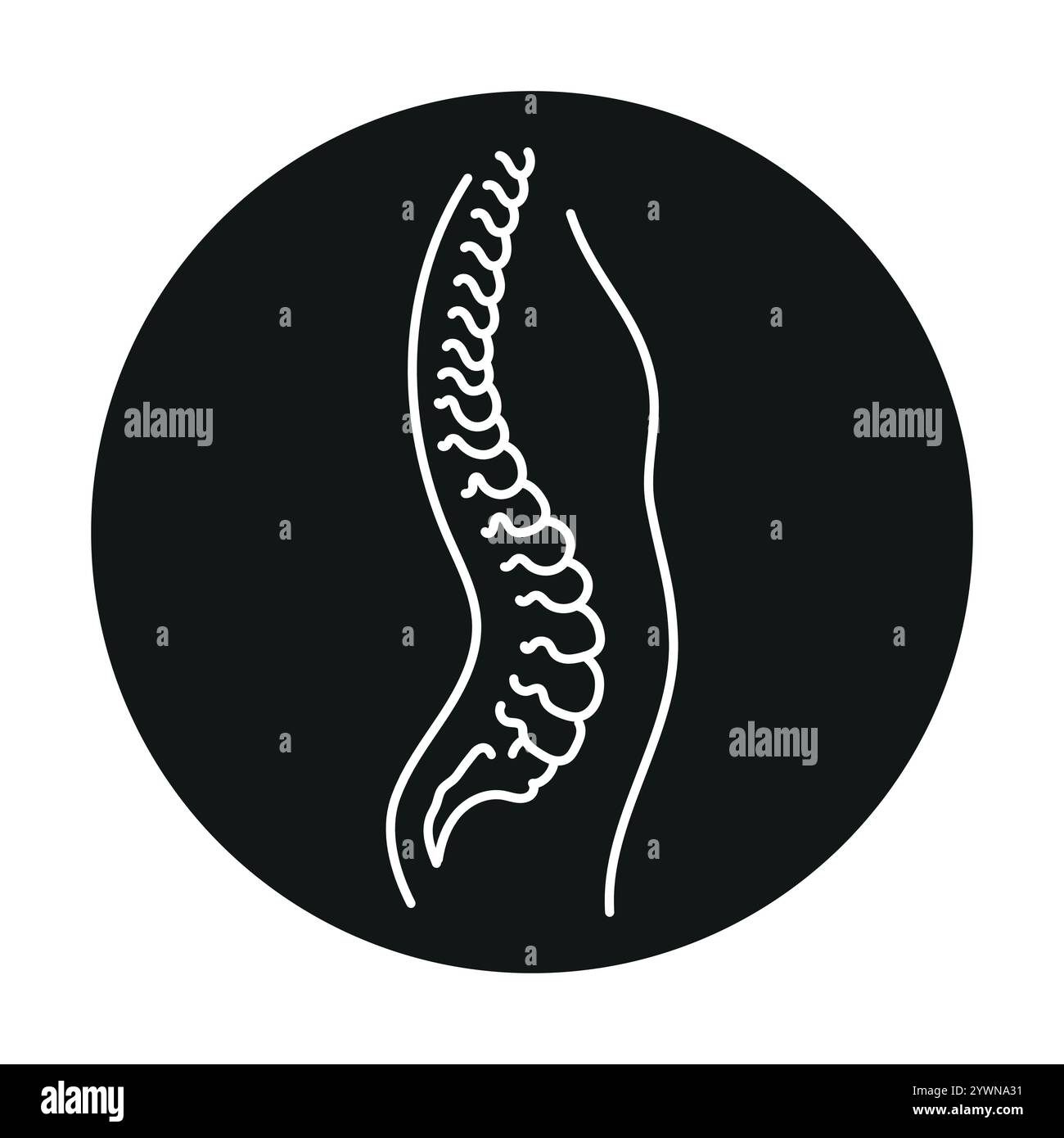 Lordosis color line icon. Diseases of the spine. Vertebrology. Vector ...