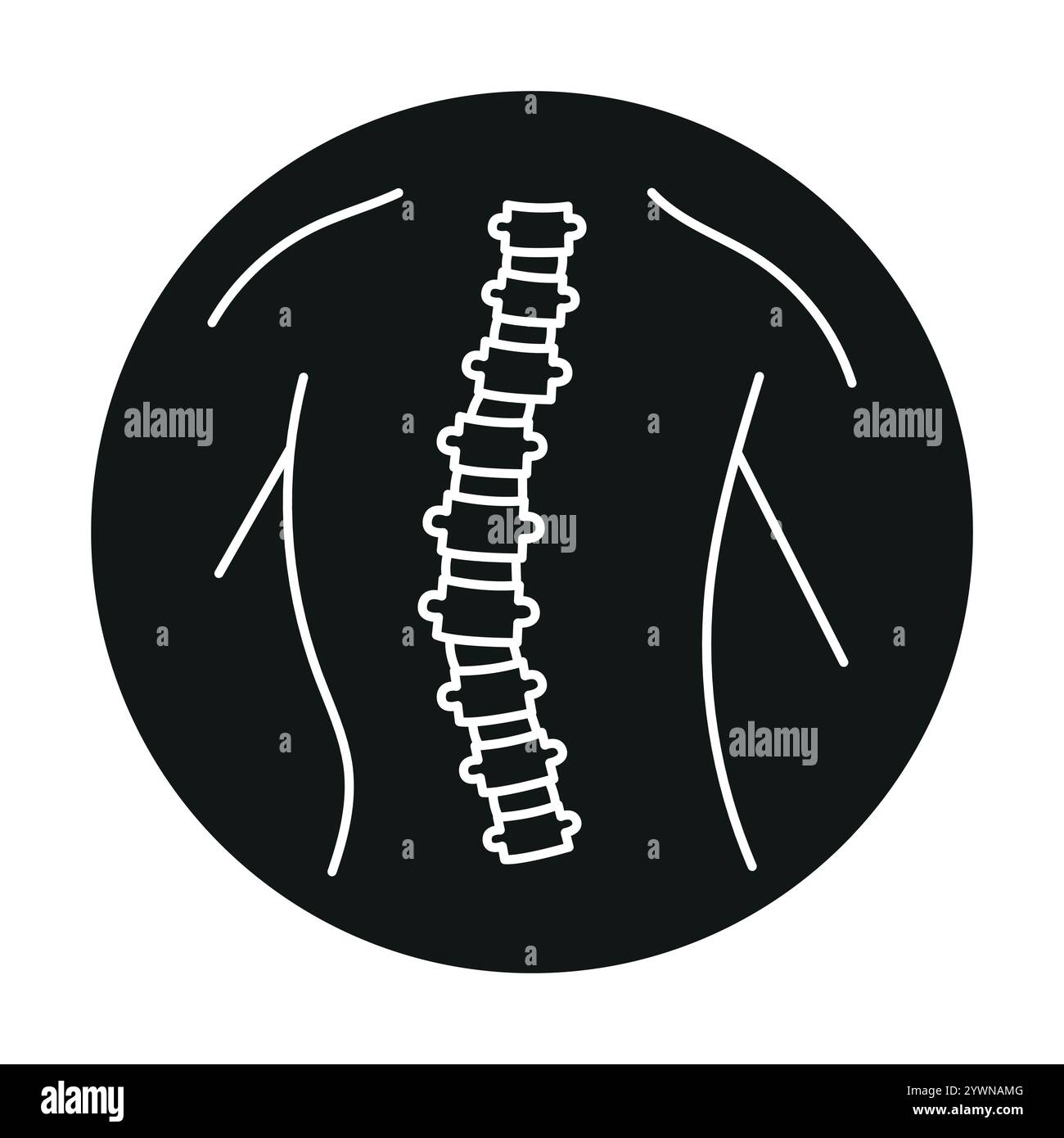 Scoliosis color line icon. Diseases of the spine. Vertebrology. Vector ...