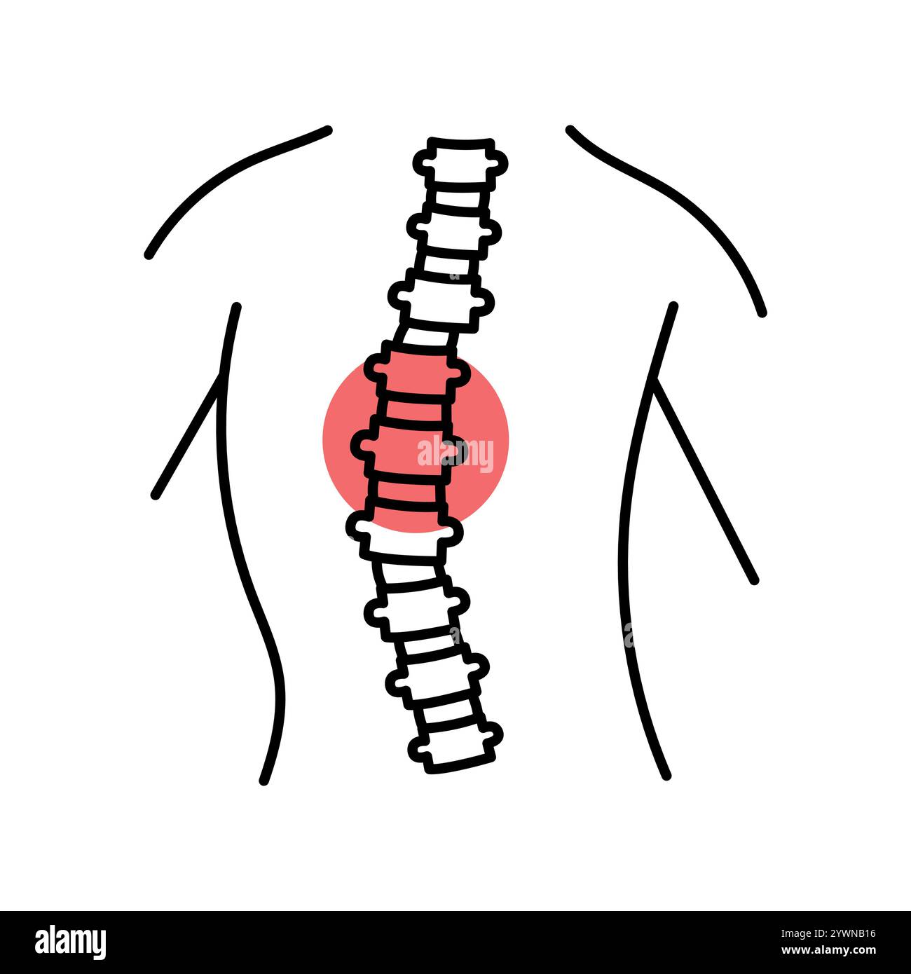 Scoliosis color line icon. Diseases of the spine. Vertebrology. Vector ...