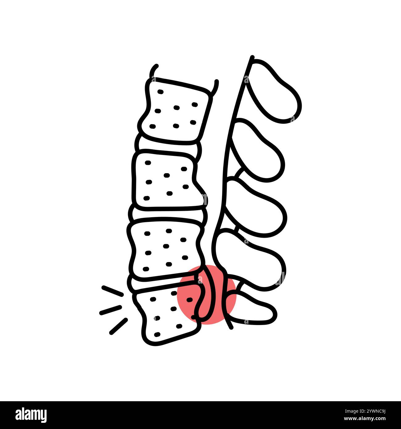 Spinal abscess color line icon. Diseases of the spine. Vertebrology ...