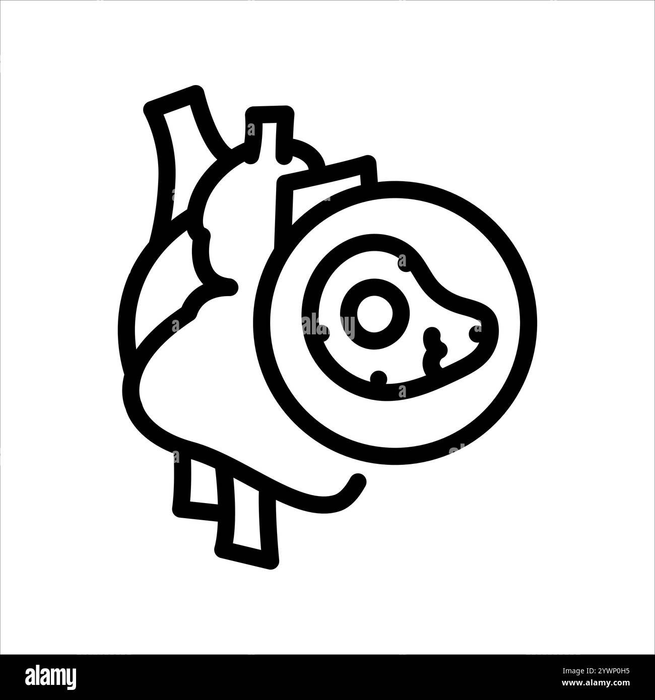 Atherosclerosis line black icon. Sign for web page, mobile app, button ...