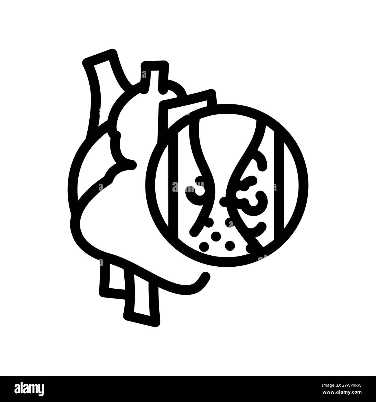 heart disease line black icon. Sign for web page, mobile app, button ...