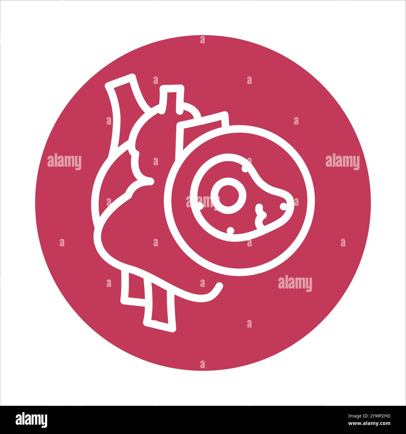 Atherosclerosis line black icon. Sign for web page, mobile app, button ...