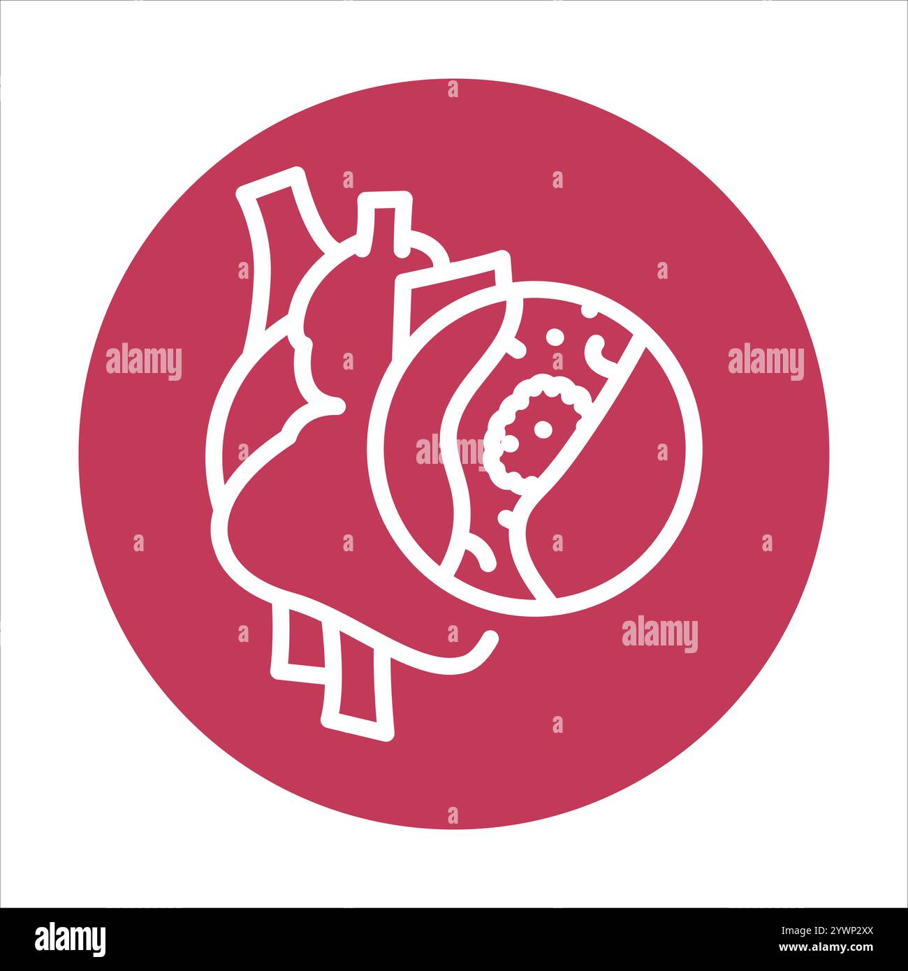 Thrombosis of the heart line black icon. Sign for web page, mobile app ...