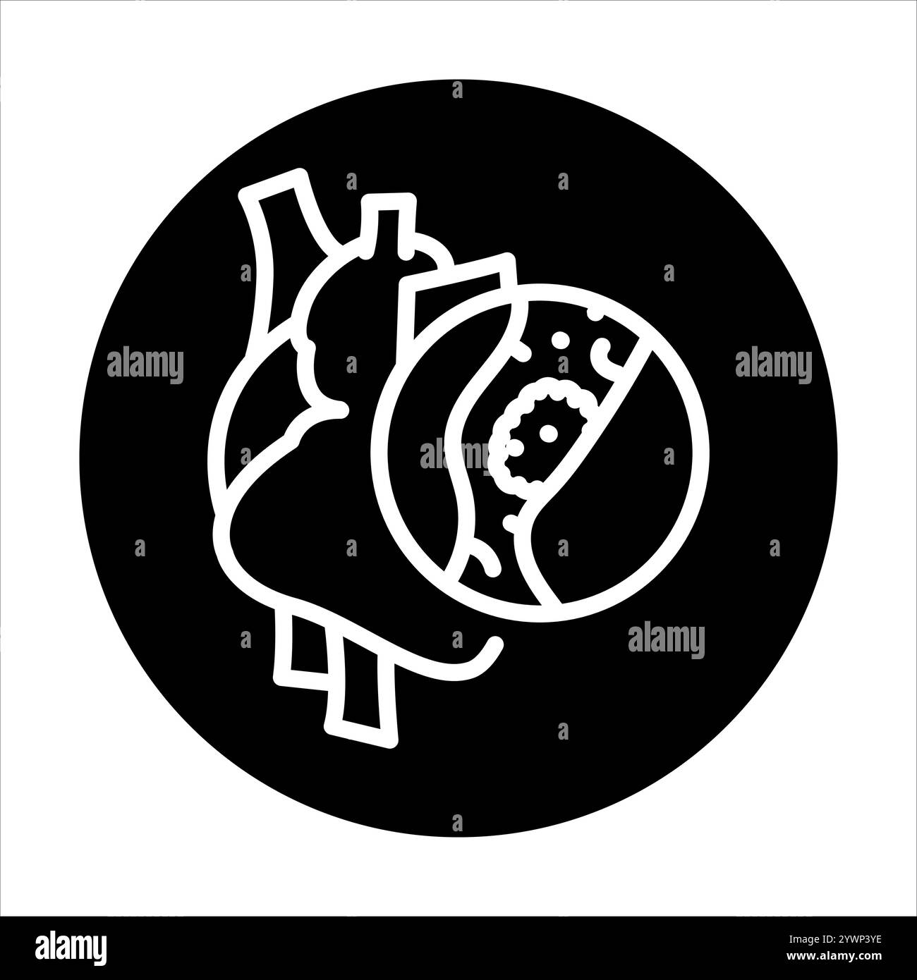 Ischemia vector vectors Black and White Stock Photos & Images - Alamy