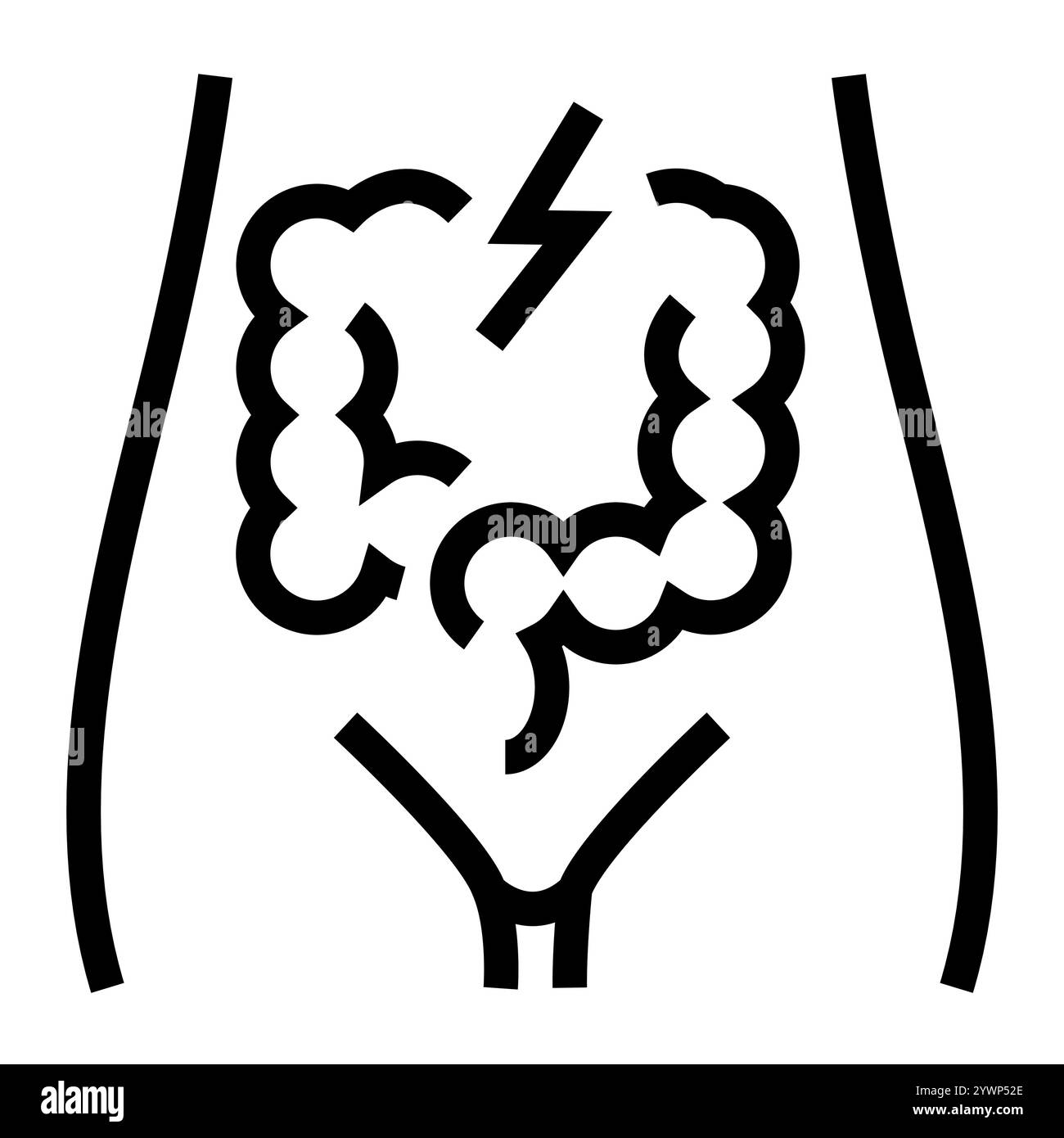 Menstrual disorder Black and White Stock Photos & Images - Alamy