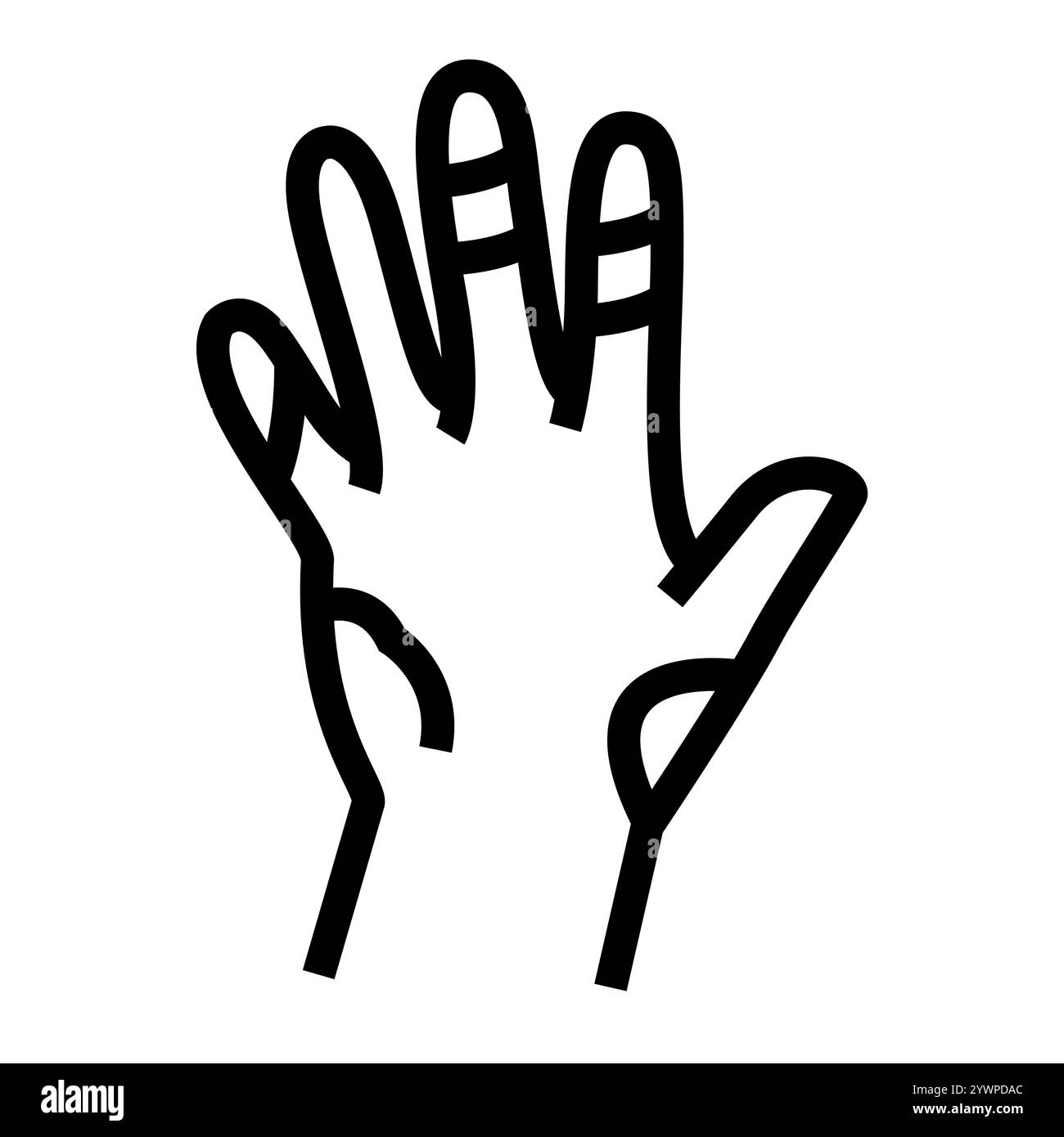 Systemic sclerosis Stock Vector Images - Alamy